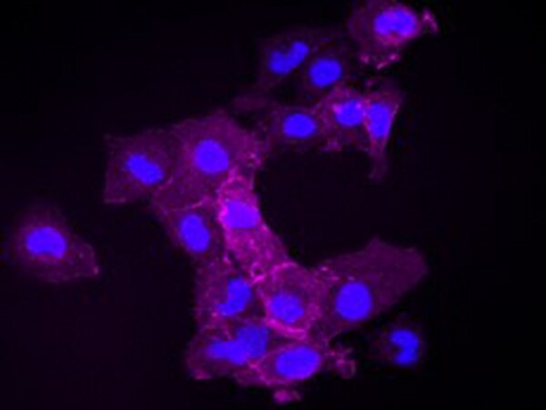 UM-SCC-105 Human Squamous Carcinoma Cell Line | SCC189